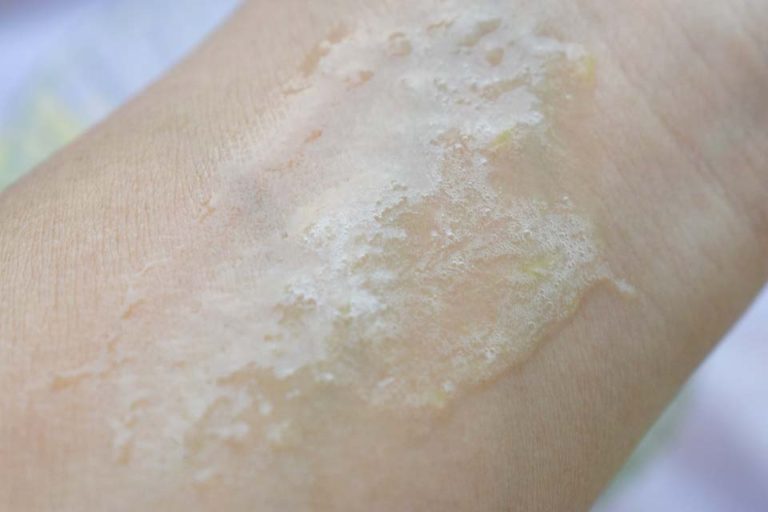 Aloevera - Lemon Serum For Bright & Clear Complexion : DIY - High On Gloss
